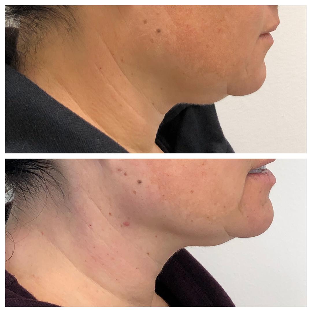 N Philadelphia PA, Center City Oral and Maxillofacial Surgery